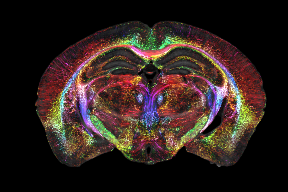 Brain Portal | Duke Institute for Brain Sciences